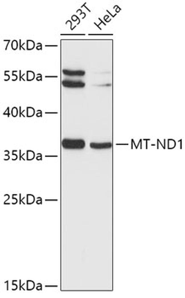 MT-ND1 Antibody (PA5-109992)