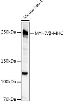 MYH7 Polyclonal Antibody (PA5-110000)