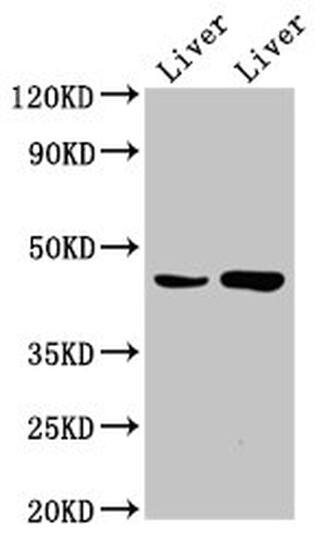 CHKB Antibody (PA5-112385)
