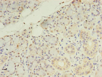 ZDHHC4 Polyclonal Antibody (PA5-113390)