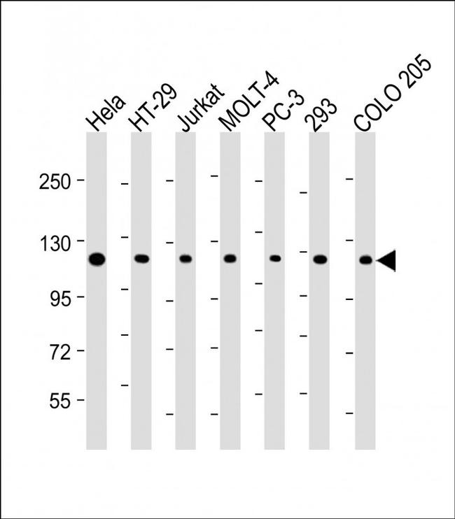 TERT Polyclonal Antibody (PA5-11446)