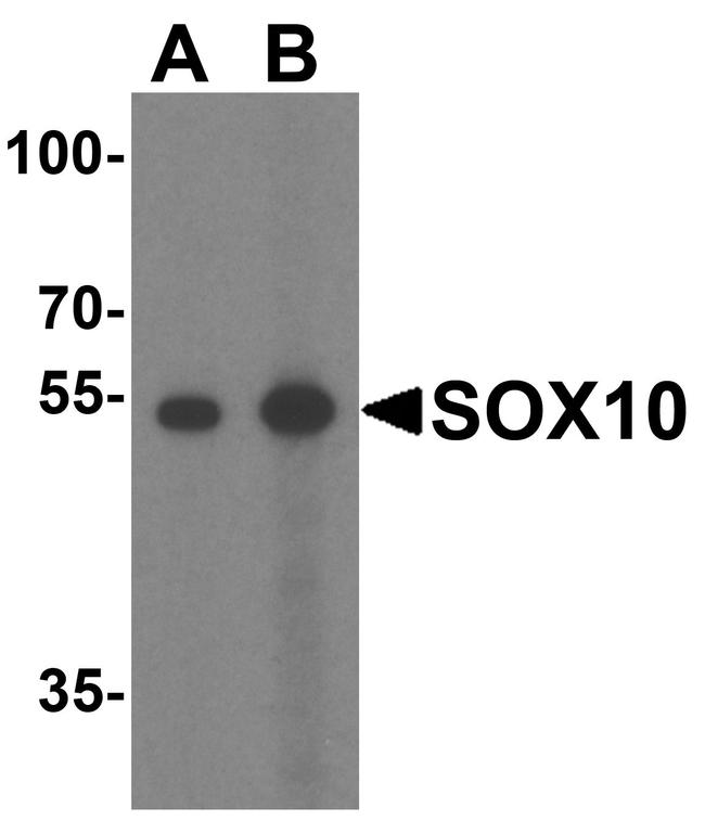 SOX10 Antibody (PA5-114513)