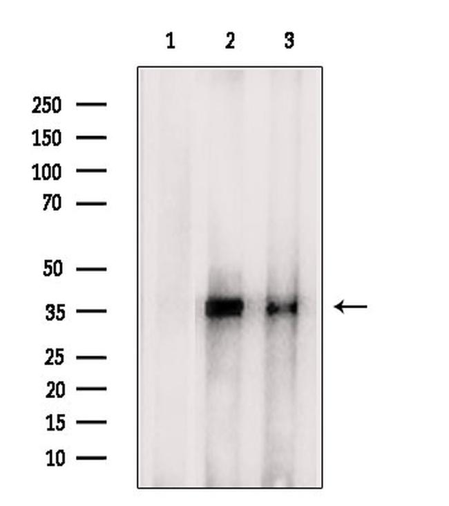 IBSP Polyclonal Antibody (PA5-114915)