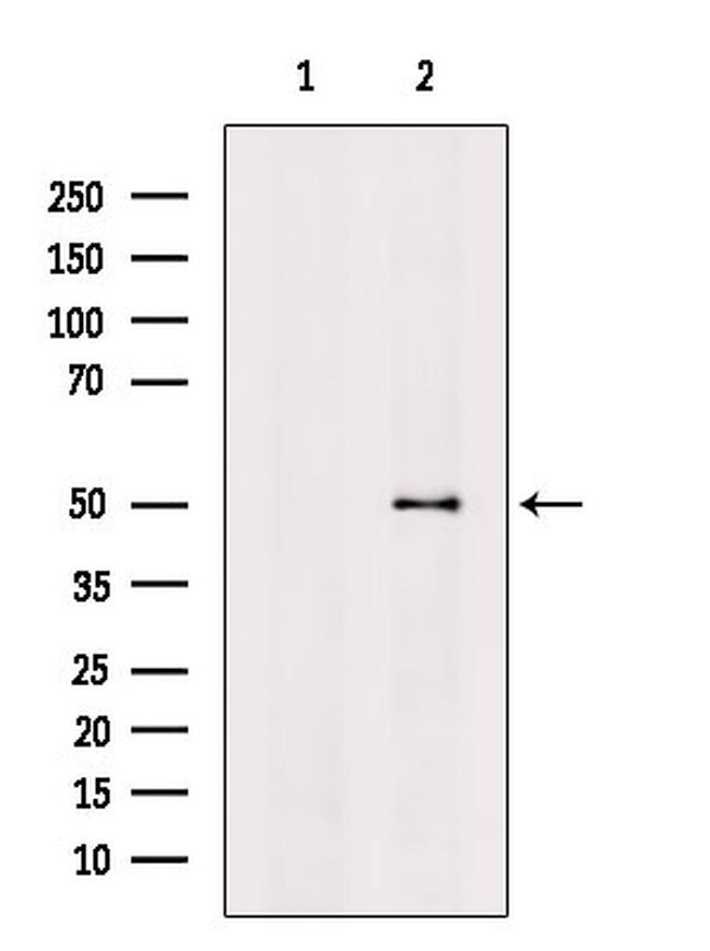 CCR8 Antibody (PA5-114966)