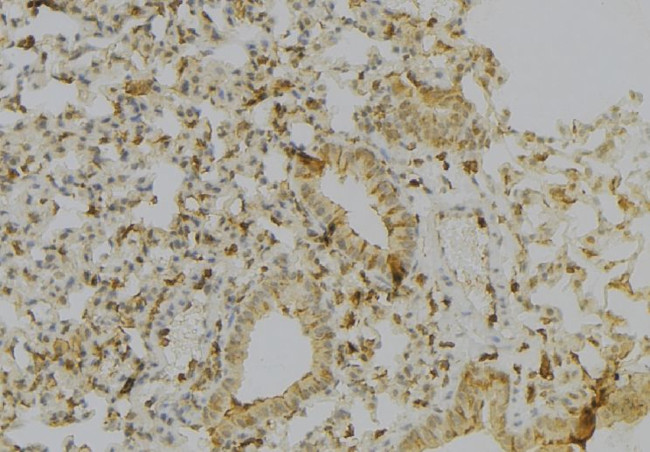 HLA-ABC Polyclonal Antibody (PA5-115364)