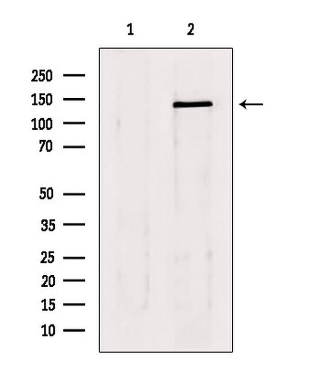 LATS1/LATS2 Antibody (PA5-115498)