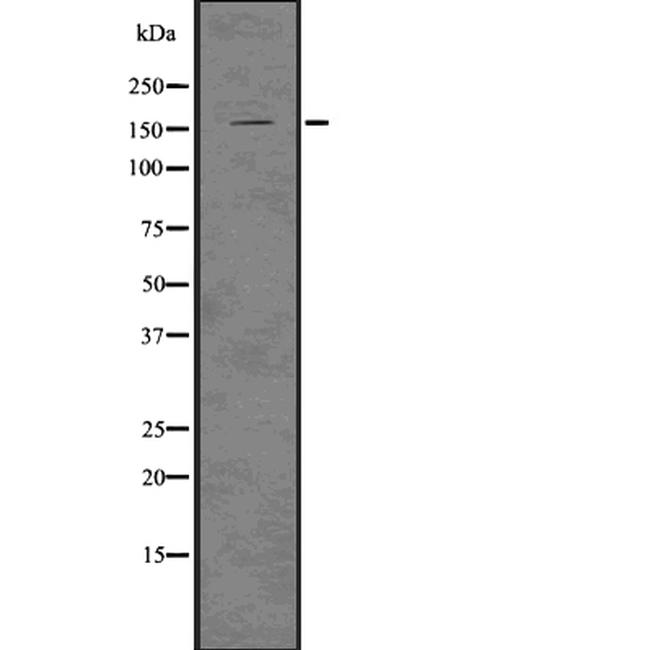 LATS1/LATS2 Antibody (PA5-115498)