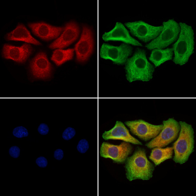 TSPO Polyclonal Antibody (PA5-115723)