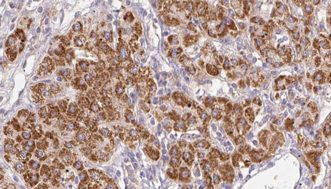 SLC22A6 Polyclonal Antibody (PA5-115910)