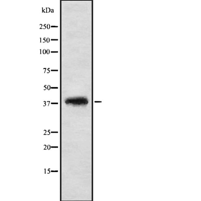 CHX10 Antibody (PA5-116119)