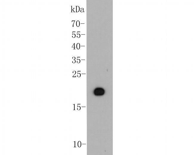 CDKN2B Antibody (PA5-116445)