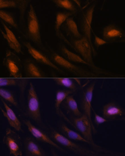 UBE2S Antibody (PA5-117003)