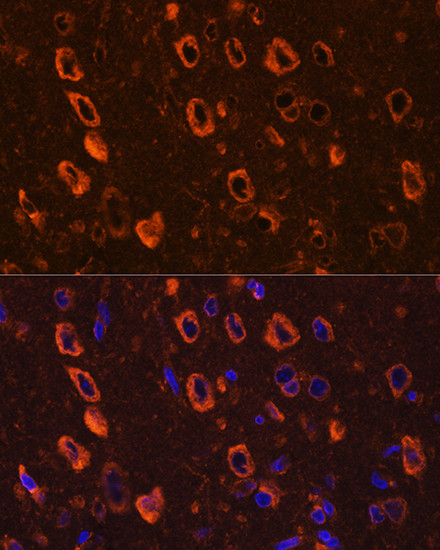 Phospho-Tau (Ser416) Antibody (PA5-117246)