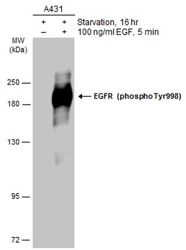 Phospho-EGFR (Tyr998) Polyclonal Antibody (PA5-117385)