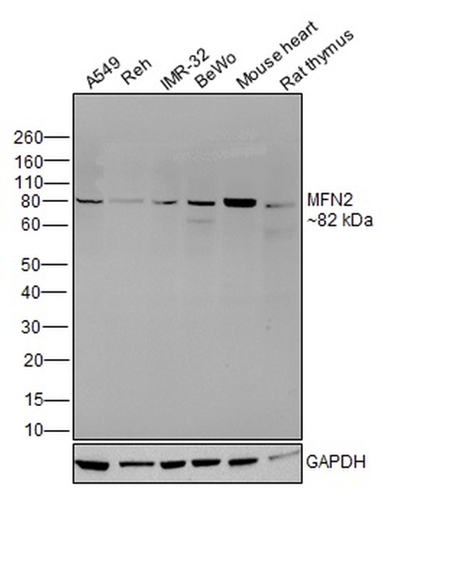 MFN2 Polyclonal Antibody (PA5-118059)
