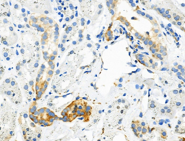 Phospho-ATP1A1 (Tyr260) Antibody (PA5-118769)