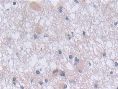 FADS2 Antibody (PA5-119108)