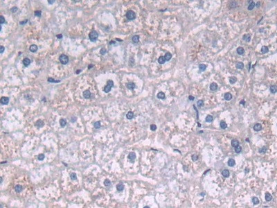 FADS2 Antibody (PA5-119108)
