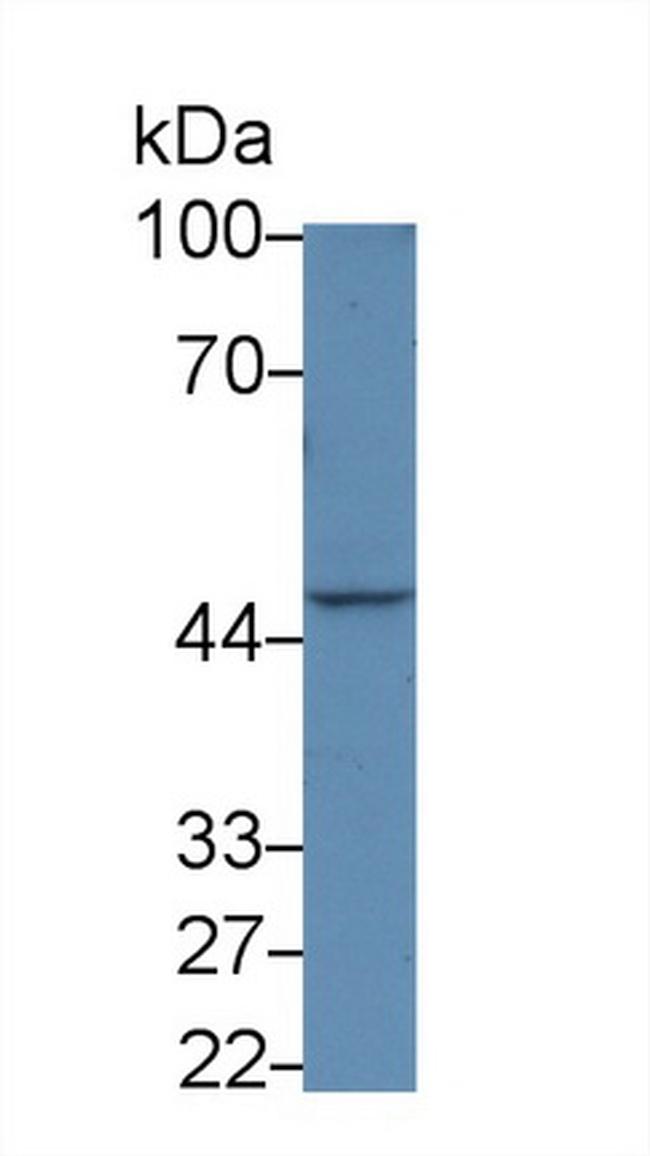 IL31RA Antibody (PA5-119229)