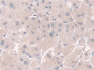 PGM1 Antibody (PA5-119338)