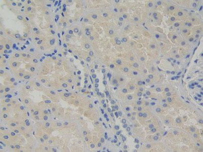 PIK3AP1 Antibody (PA5-119342)
