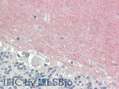 VCAN Antibody (PA5-119502)