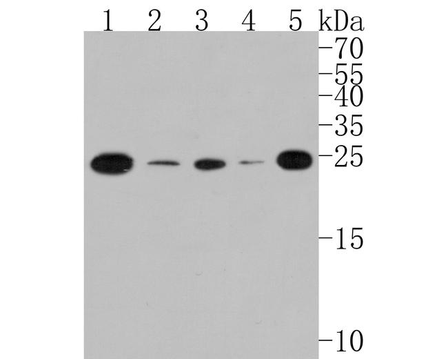 TCF21 Polyclonal Antibody (PA5-119812)