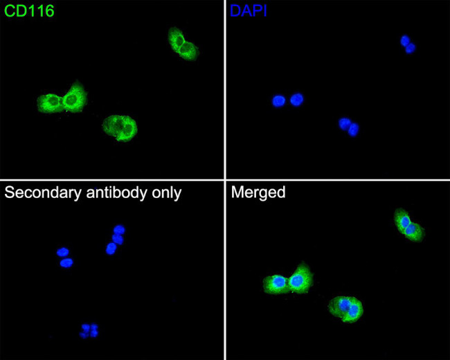 CD116 Antibody (PA5-119906)