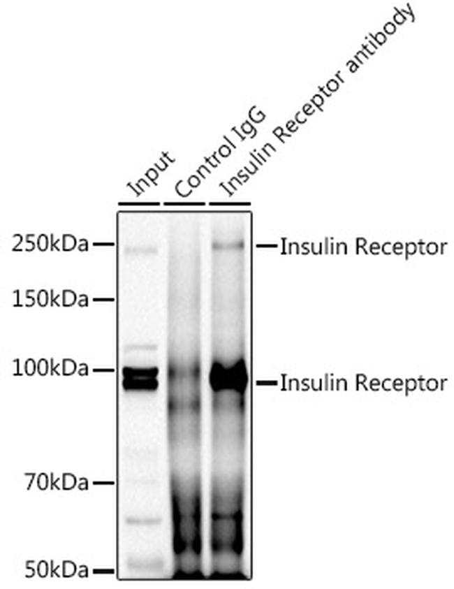 INSR Antibody (PA5-120502)