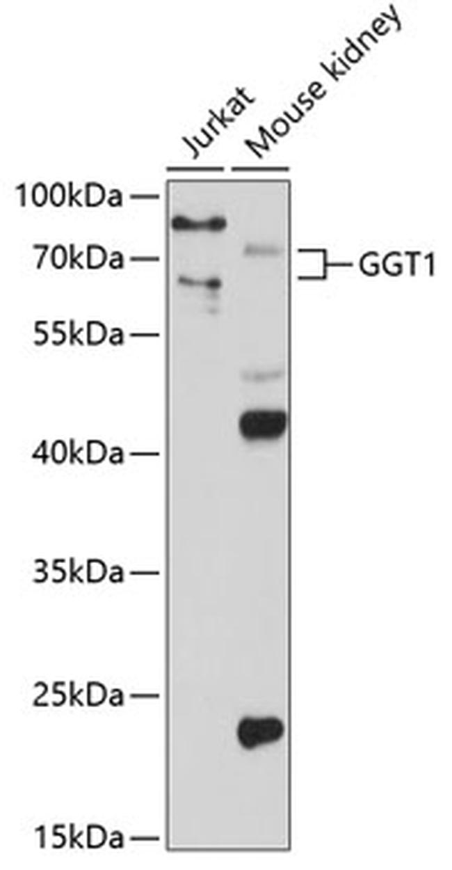 GGT1 Antibody (PA5-120579)