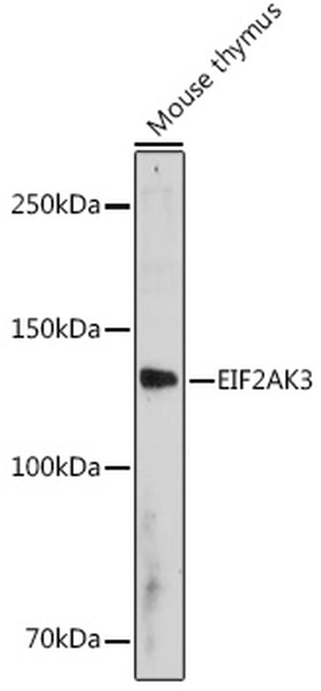 PERK Antibody (PA5-120620)