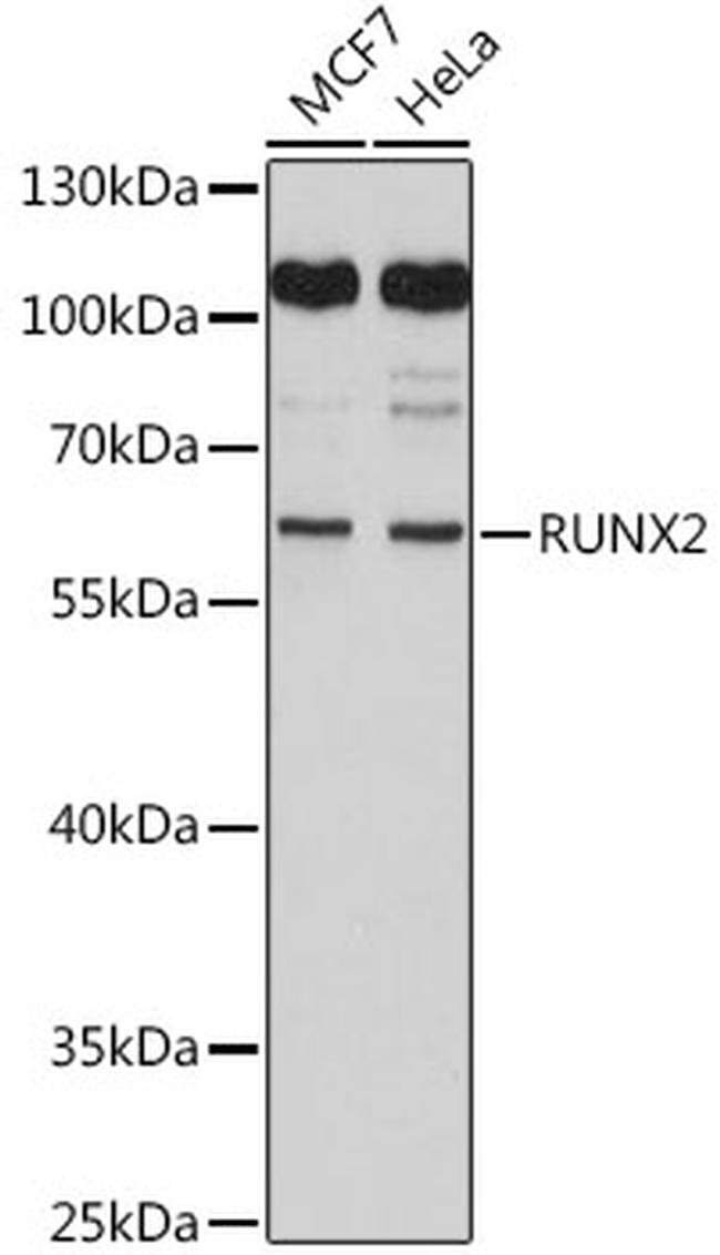 RUNX2 Antibody (PA5-120837)