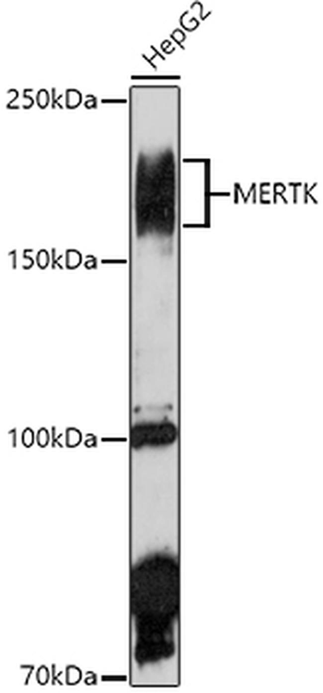 MERTK Antibody (PA5-120917)
