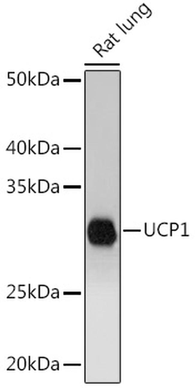 UCP1 Antibody (PA5-120958)
