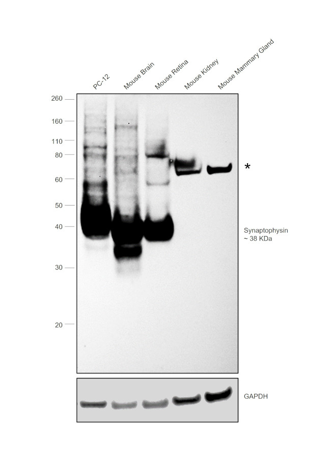 Synaptophysin Polyclonal Antibody (PA5-120989)
