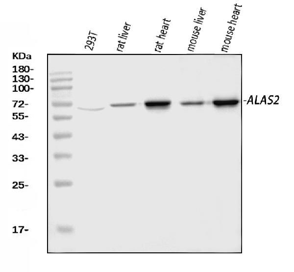 ALAS2 Polyclonal Antibody (PA5-143885)