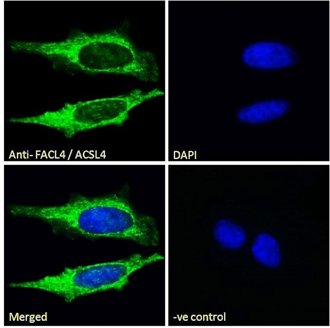 ACSL4 Polyclonal Antibody (PA5-18099)