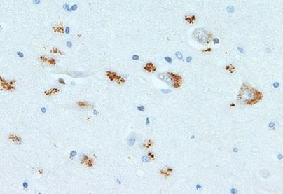 SCF Polyclonal Antibody (PA5-19793)