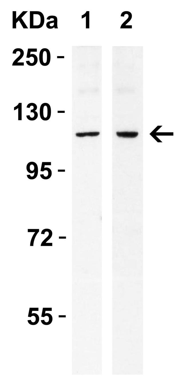 IRE1 alpha Polyclonal Antibody (PA5-20189)