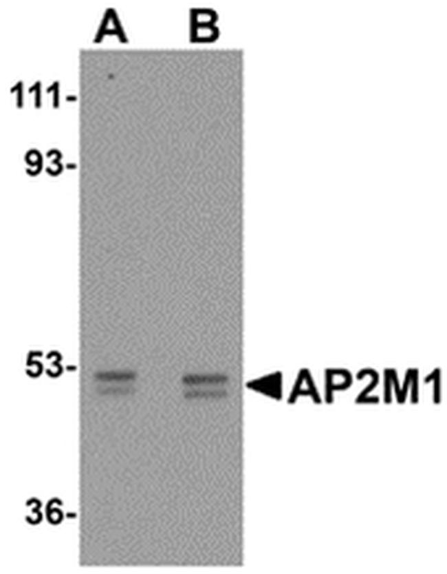 AP2M1 Antibody (PA5-20745)