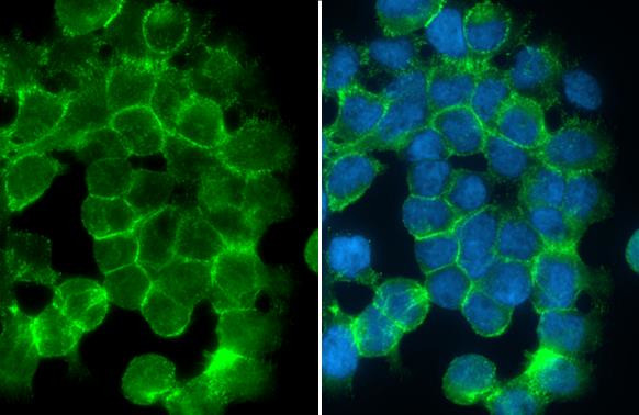 Desmoglein 2 Antibody (PA5-21444)