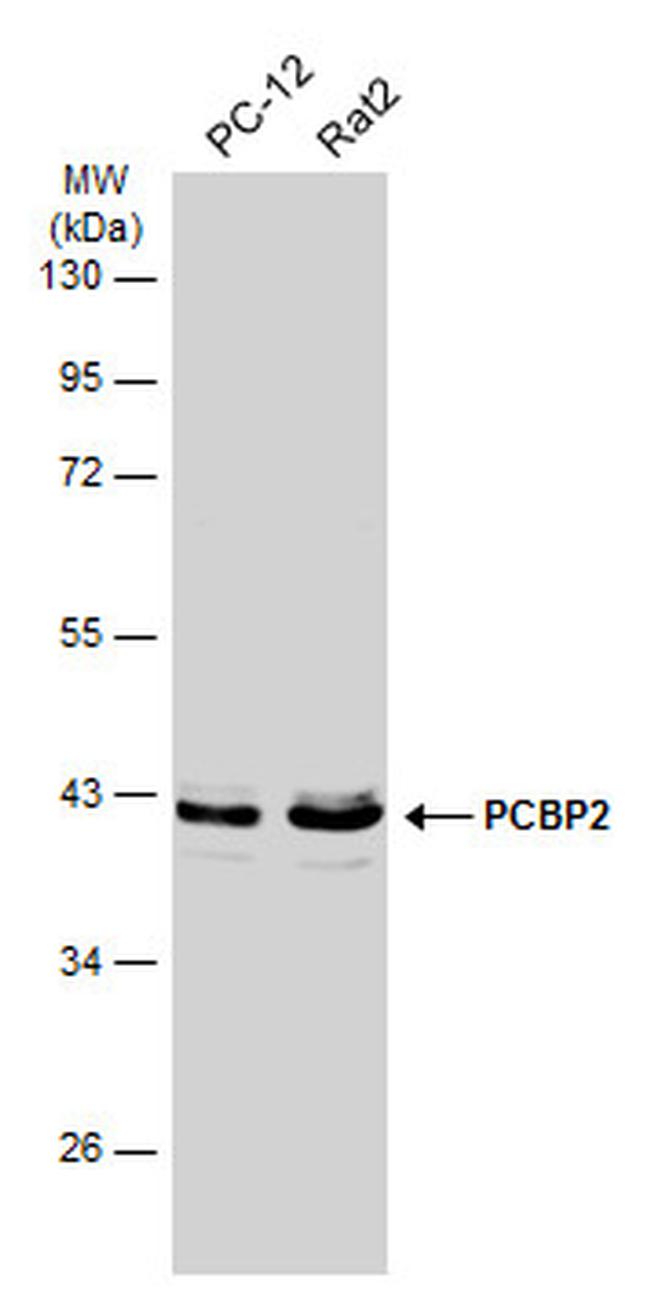 PCBP2 Antibody (PA5-22350)