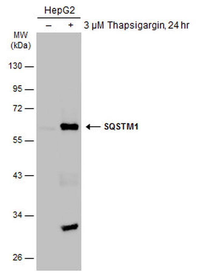SQSTM1 Antibody (PA5-27247)
