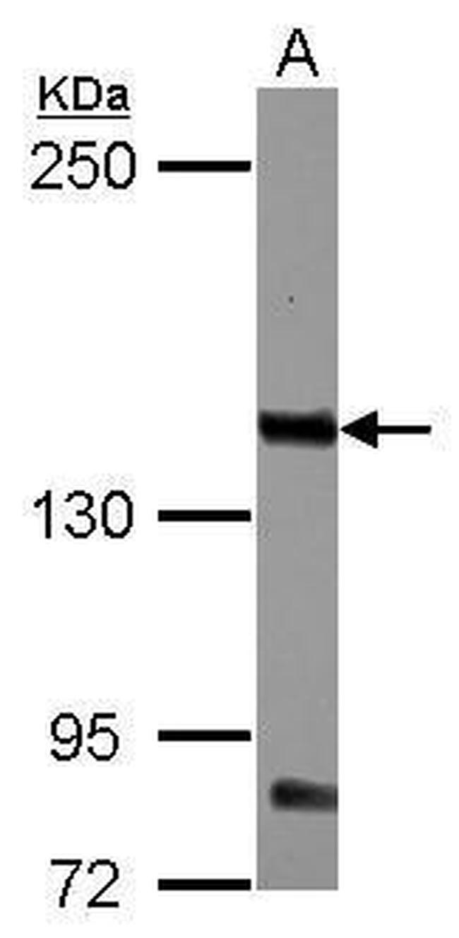 CSF2RB Antibody (PA5-28000)