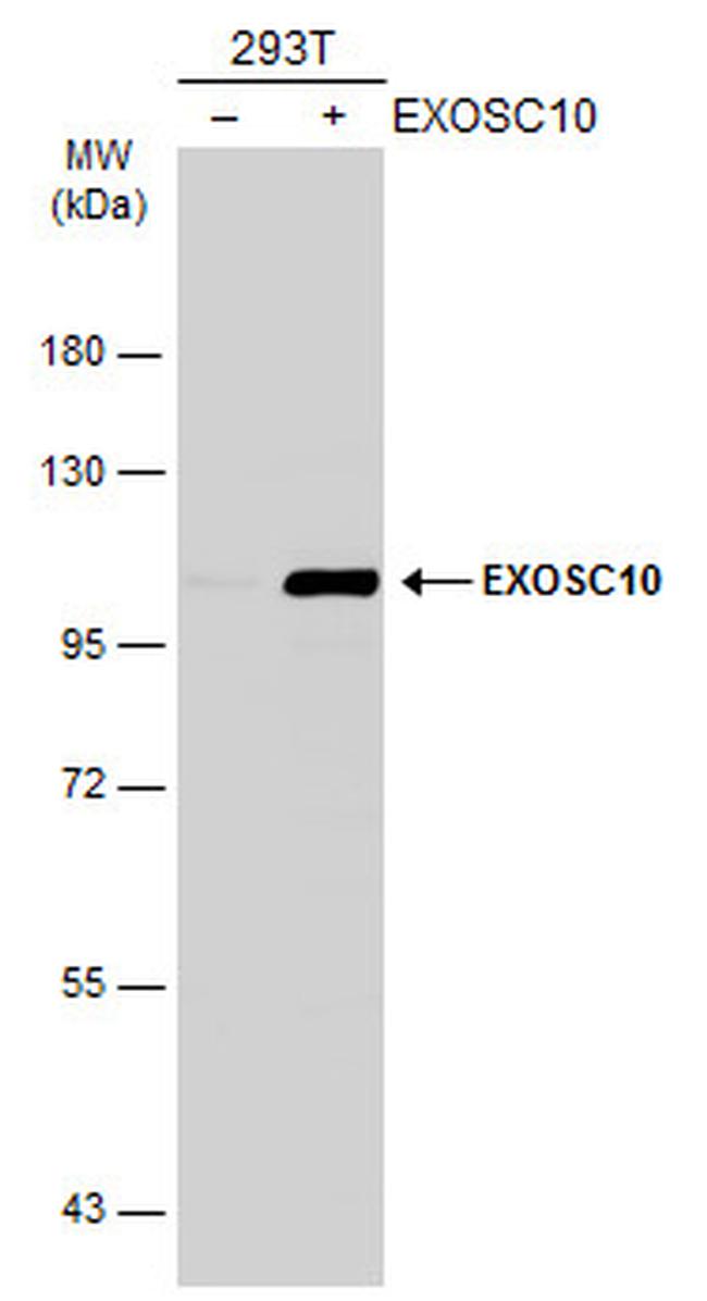 EXOSC10 Antibody (PA5-28589)