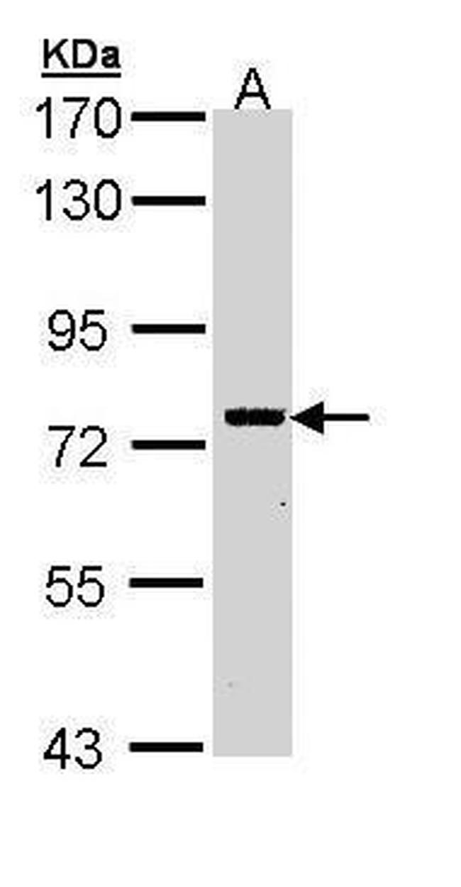 RIP1 Polyclonal Antibody (PA5-29223)
