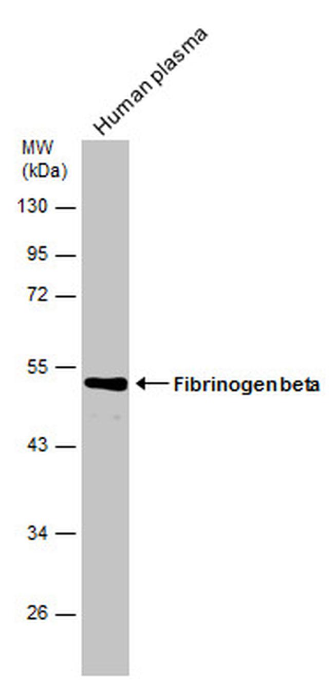 FIBB Antibody (PA5-29805)