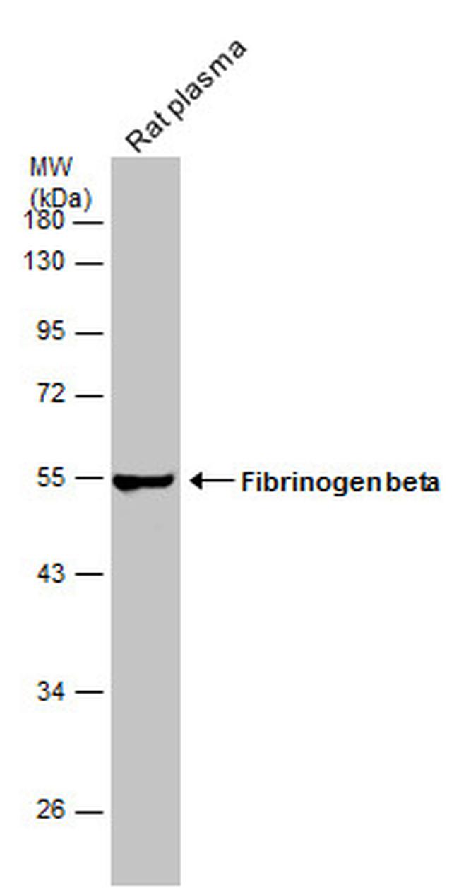 FIBB Antibody (PA5-29805)