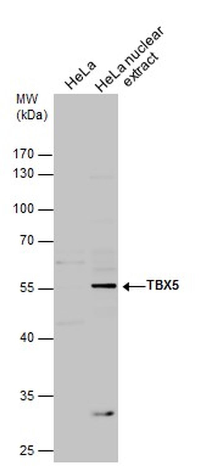 TBX5 Antibody (PA5-29845)
