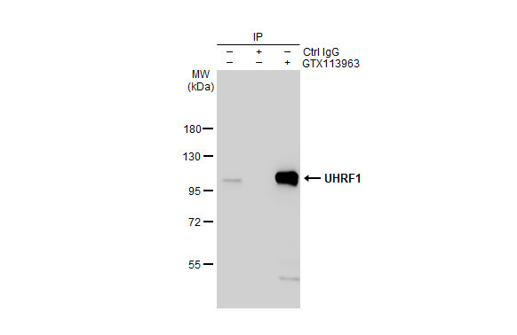 UHRF1 Antibody (PA5-29884)